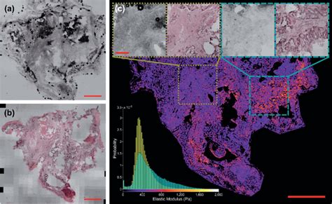 Liver Tissue Sample G340 03 02 Classified As Tumour A Shows Download Scientific Diagram