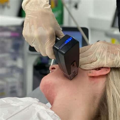 Most Effective Morpheus 8 Treatment In Miami Apprize Beauty