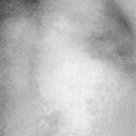 Diffuse Cutaneous Telangiectasia Of The Trunk At Age 3 Years