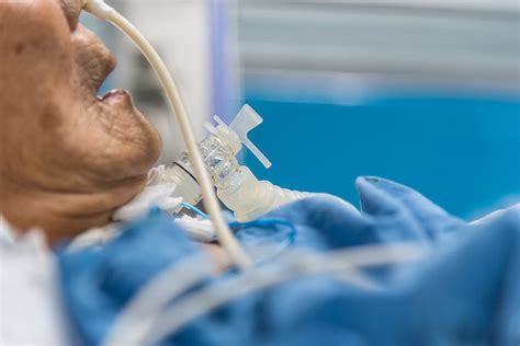 Adult Als Program Overview Acccn