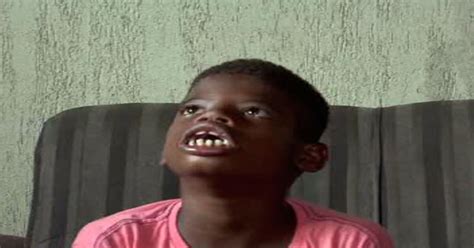 Pai faz apelo para filho conseguir cirurgia odontológica Quando come