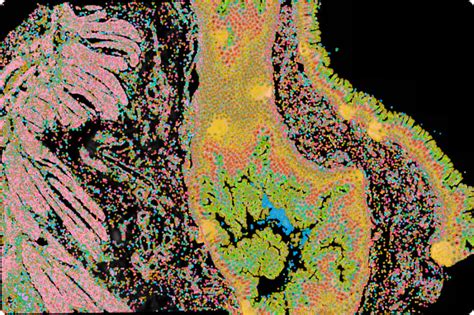 Xenium Panels 10x Genomics