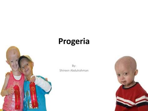 Progeria Pptx