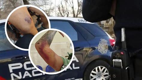 Joven Arrollado Por Ladrones Tras Intento De Robo De Cigarrillos