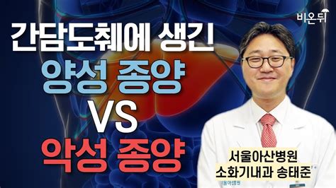 간담도췌에 생긴 양성 종양 Vs 악성 종양 구별법 서울아산병원 소화기내과 송태준 Youtube