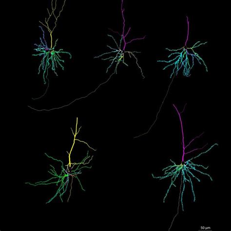 3 Examples Of Reconstructions Of Pyramidal Neurons In The Anterior Download Scientific Diagram