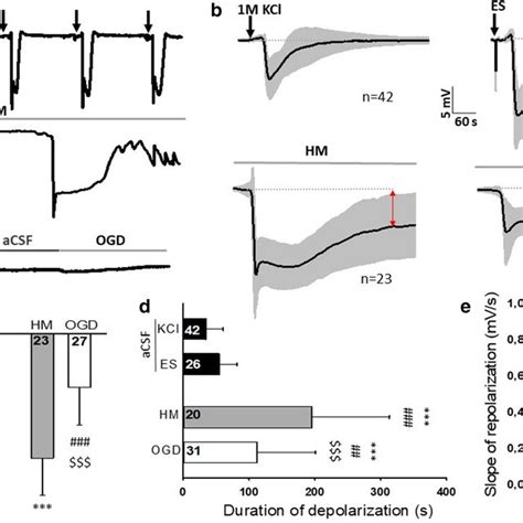 Electrophysiological Characterization Of Spreading Depolarizations Download Scientific Diagram