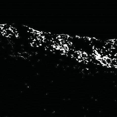 B The Processed Image After Performing Otsu Thresholding On Fig 1a