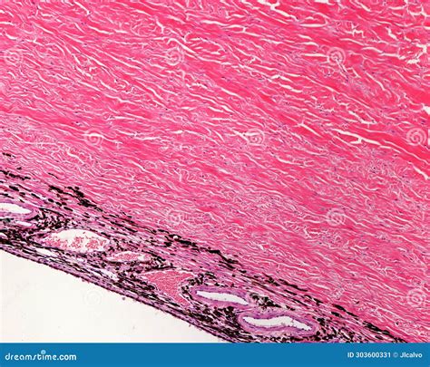 Eye Sclera And Choroid Stock Image Image Of Anatomy 303600331