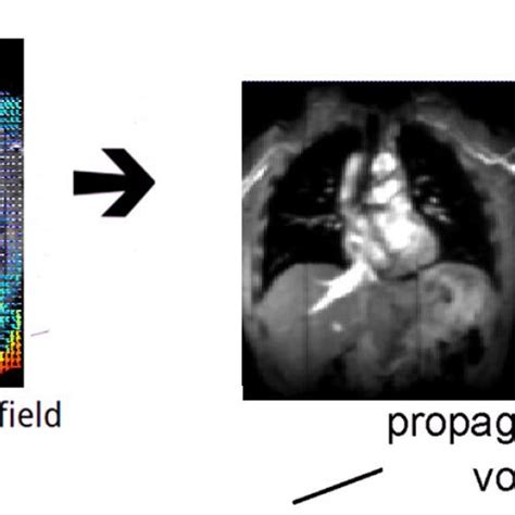 Estimated Full 3d Vector Fields Constrained By An Eigenbasis Allowing