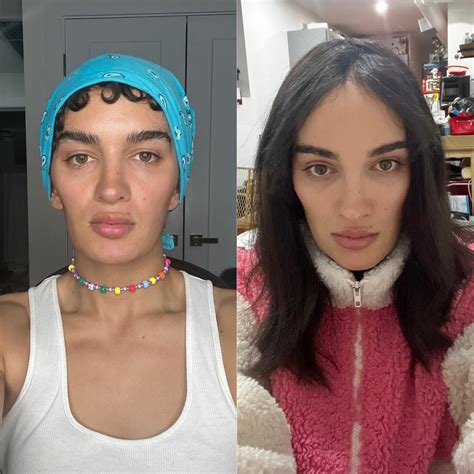 Pre Ffs To 8 Weeks Post 28 Mtf 16 Weeks Hrt Rtranstimelines