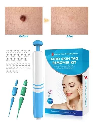 Kit De Eliminación De Verrugas Cutáneas Sin Dolor 2 En 1 Cuotas sin