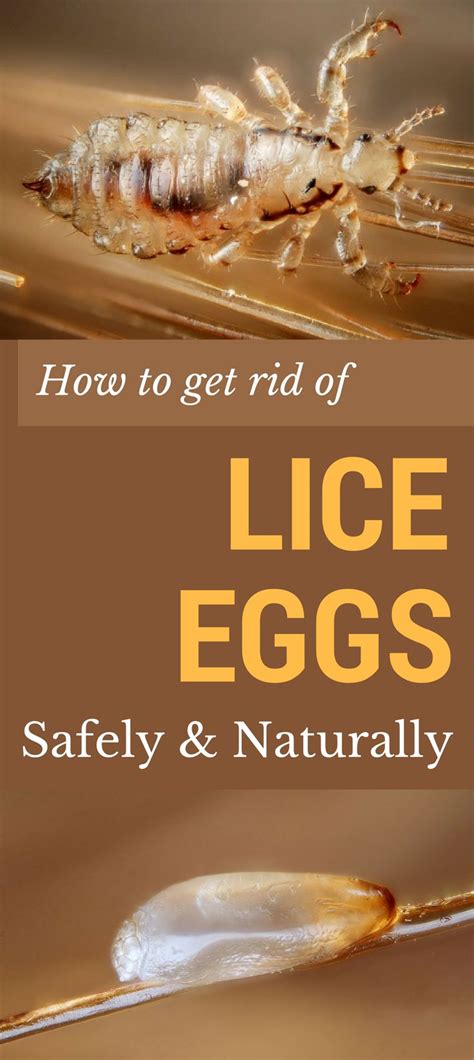 How To Get Rid Of Lice Eggs Safely And Naturally Lice Eggs Cleaner