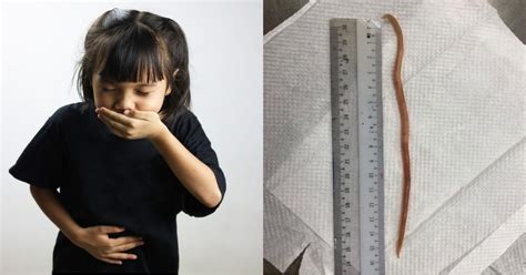 Kepentingan Ubat Cacing Pengambilan Klinik Dr Arifah