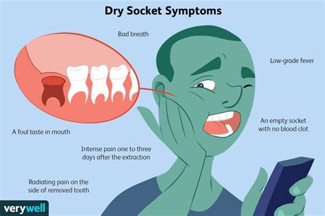 apa itu dry socket dan apa saja penyebabnya arini dental care