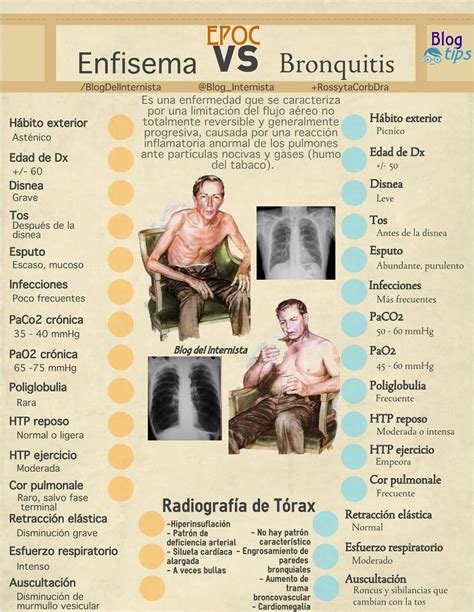 Blog Del Internista BlogTips Infographics