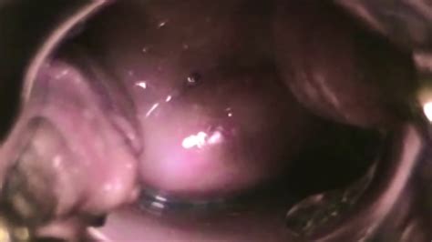 Internal Orgasm Of My Wife Eporner