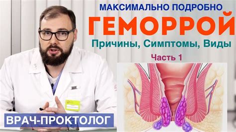 Геморрой Фото Симптомы Как Лечить Telegraph