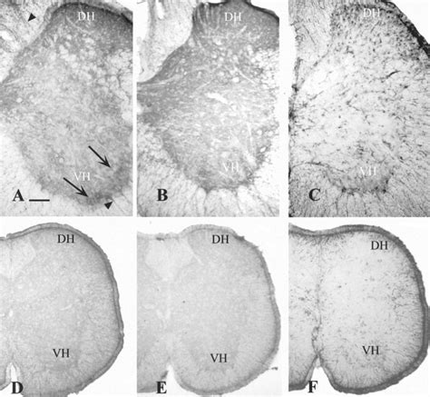 Immunocytochemical Localization Of Aqp4 Ad Glt 1 Be And Gfap