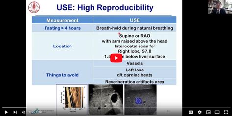 The Blue Protocol Lung Ultrasound For Diagnosing Acute Respiratory
