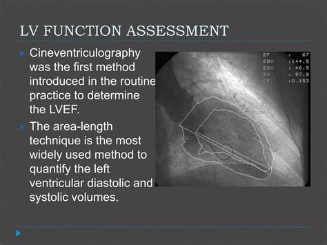 Left Ventricular Angiogram 1 Pptx