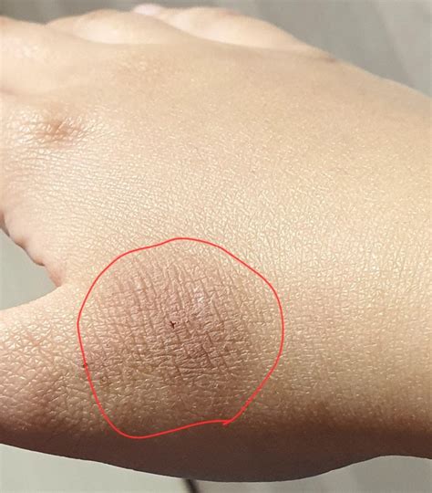 피부 검은색 변함 건조 지식in