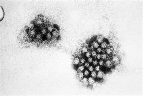 Free Picture Electron Micrograph Norovirus 32nm Sized Viral Particles