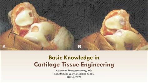 Basic Knowledge In Cartilage Tissue Engineering Youtube