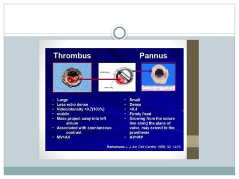 Evalutionofprostheticvalvescardiologypptpptx