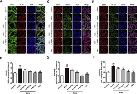 Rus Inhibits Lps Induced Tlr4myd88nf κb Signal Pathway In Pulmonary