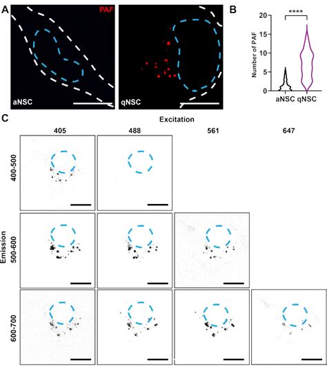 Classification Of Neural Stem Cell Activation State In Vitro Using