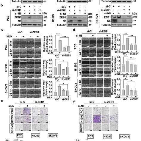 Zeb1 Knockdown Attenuates The Cell Migration Promoting Effect Of