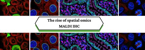 The Rise Of Spatial Omics Maldi Ihc