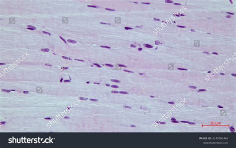 Skeletal Muscle Fibres Light Micrograph Longitudinal Stock Photo Shutterstock