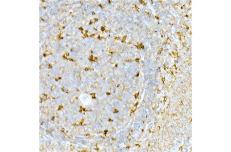 Anti Interferon Alpha Beta Receptor 1 Antibody A8960