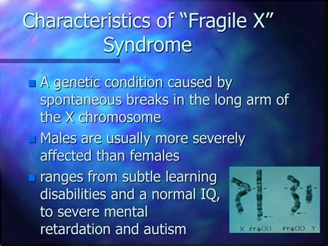 Ppt Fragile X Powerpoint Presentation Free Download Id 3473179