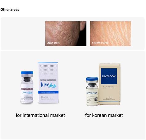 Juvelook Buy Juve Look Skin Booster Injection Reviews And Price Skin