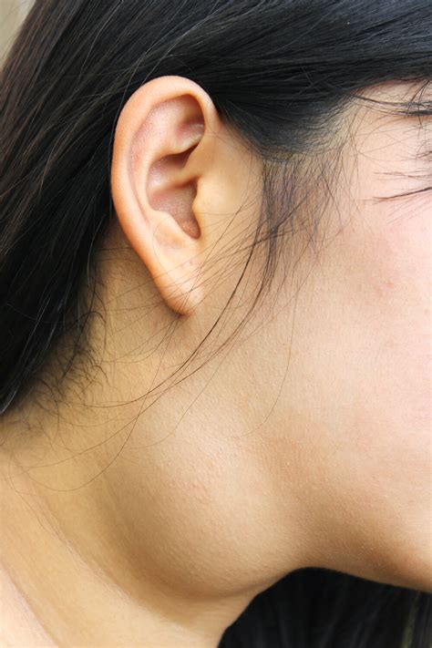 Neck Mass Lump Growth