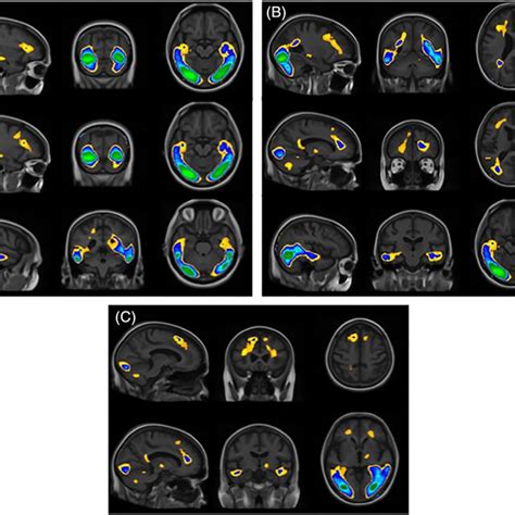 Omnibus Fmaps Visualized Using FSLeyes Visualization Tool Show