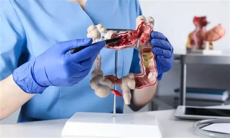 Sponge Assisted Laparoscopic Or Robotic Surgery Of Sigmoid Colon And