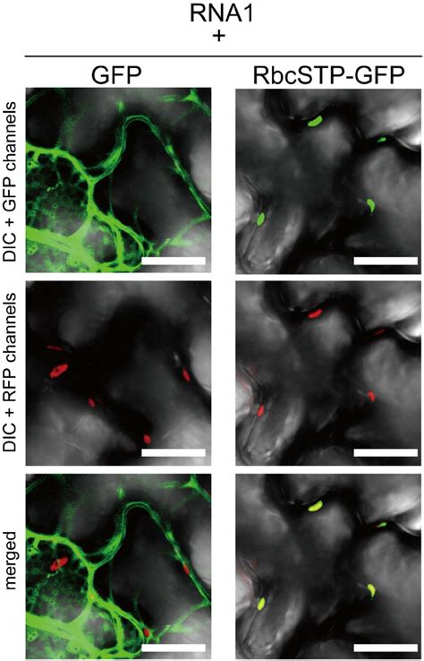 Subcellular Localization Of Free Gfp And Gfp With Chloroplast Targeting