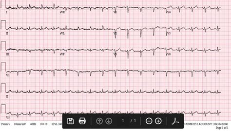 Role Of Pocus In The Diagnosis Of Acute Pericarditis Ultrasound