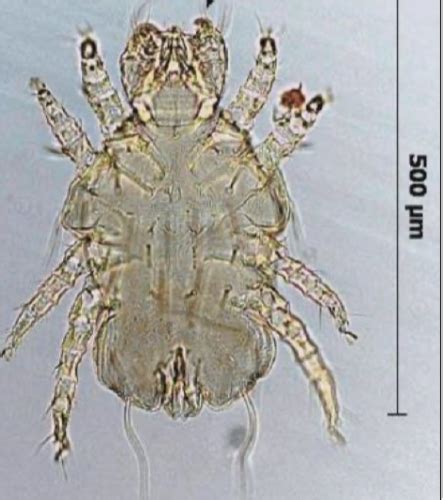 Ectoparasites Flashcards Quizlet Ectoparasites Flashcards Quizlet