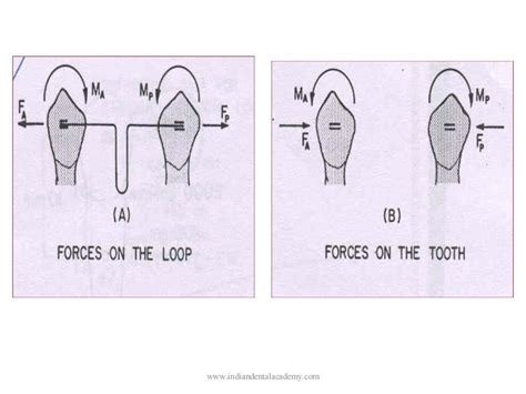 Loops In Orthodontics Certified Fixed Orthodontic Courses By Indian