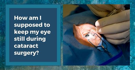 Cataract Surgery And Anesthesia Types