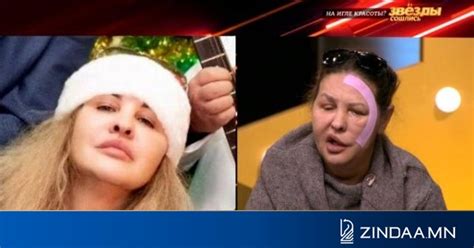 Дуучин бүсгүй арьсаа татуулаад нүүр нь мэдээгүй болжээ