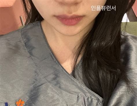 강남프라임레이즈후기 얼굴이 작아지고 싶다면 옥순레이저 네이버 블로그