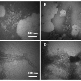A B Transmission Electron Microscopy Micrographs Negative Staining
