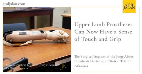 Atul Jalan On Linkedin Technology Prosthetics Engineering Medicine