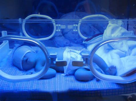 【新生儿蓝光治疗6h】母婴同室 贴心呵护